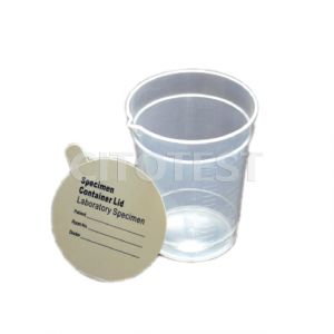 URINE AND STOOL CONTAINER, CITOTEST - SKROOLL