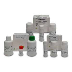 Elitech Group, selectra automated analyzer, microlab, open and ready to ...