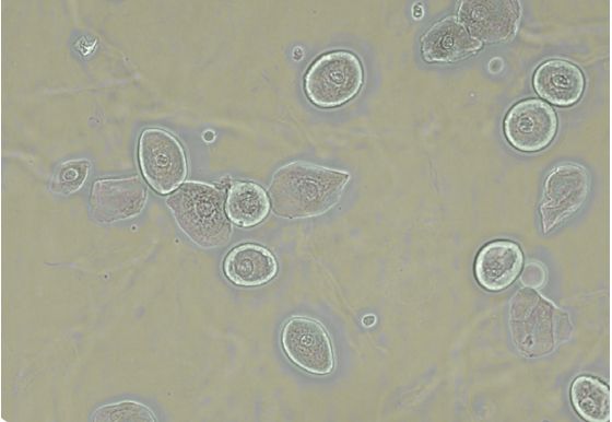 URISED MINI, 77 ELECTRONICA, URINE SEDIMENT ANALYZER | SKROOLL