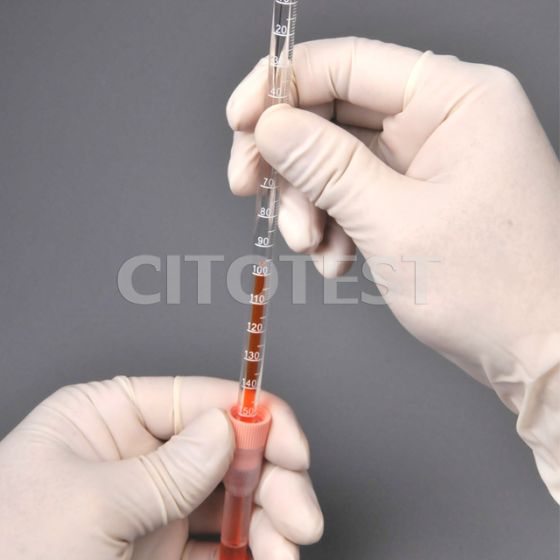 ESR PIPETTE, CITOTEST - SKROOLL